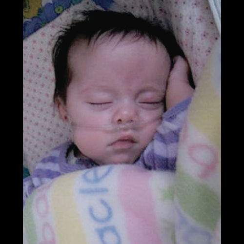 PRESSURE SAFE COMFORT SOFT PLUS NEONATAL (COLOR CODED WHITE) NASAL ...